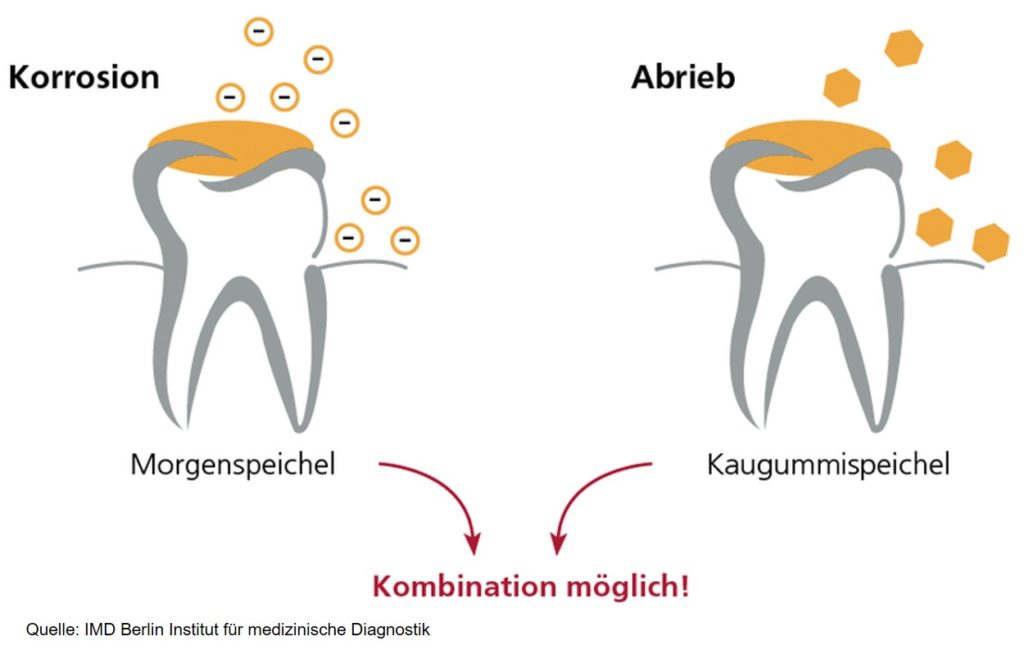 Metallnachweis im Speichel - Dr. med. dent. Louis Niestegge